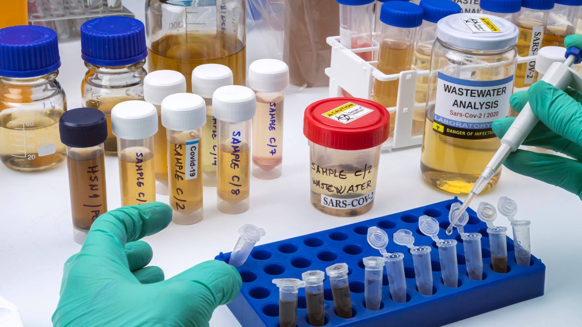 Toma de Muestras de Laboratorio a Domicilio - Emermédica